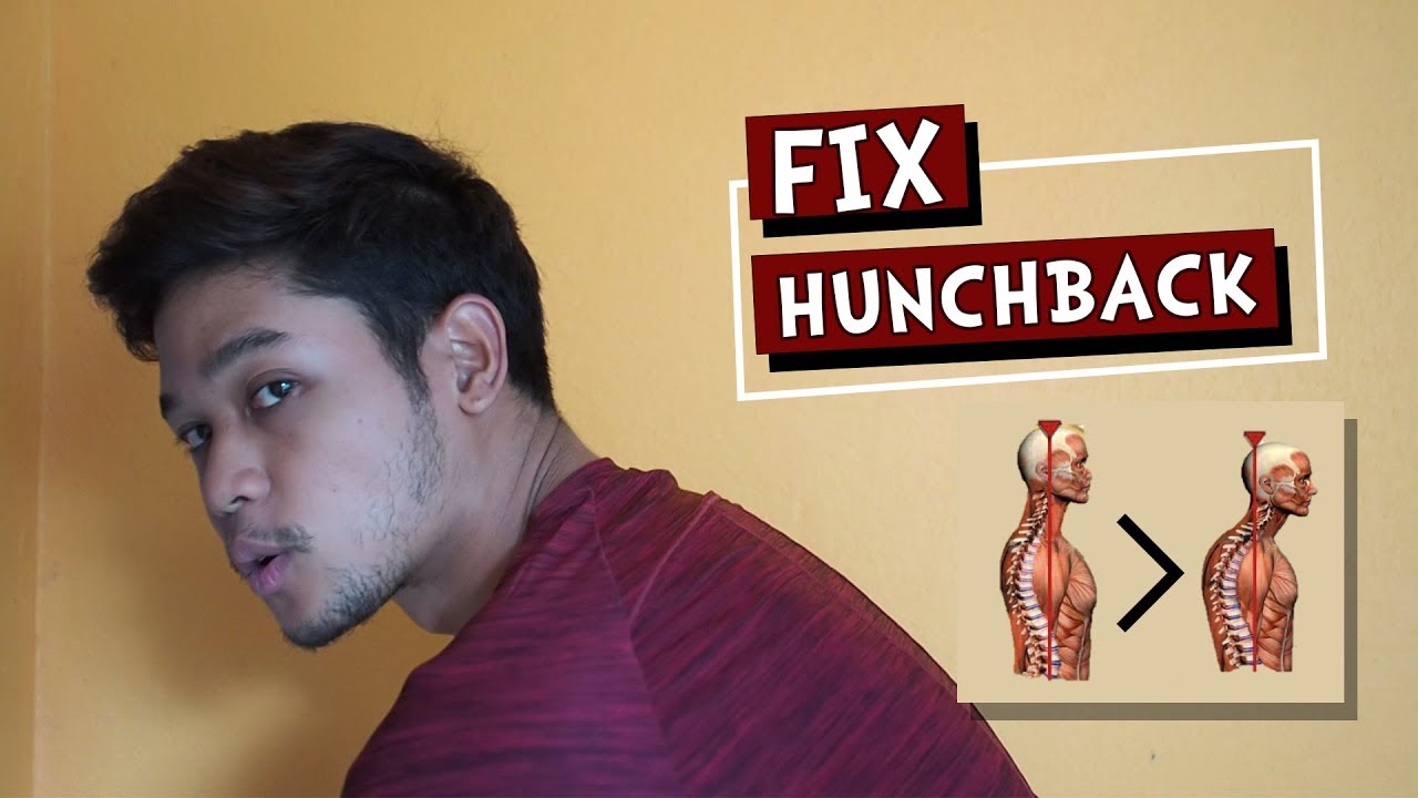 วิธีแก้ปัญหาไหล่ห่อและหลังค่อม [Fix Hunchback Posture] - YouTube