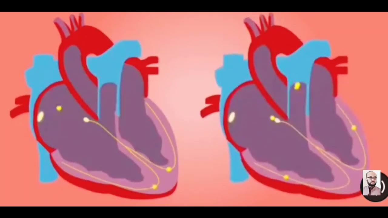 Which one is atrial flutter??? - YouTube