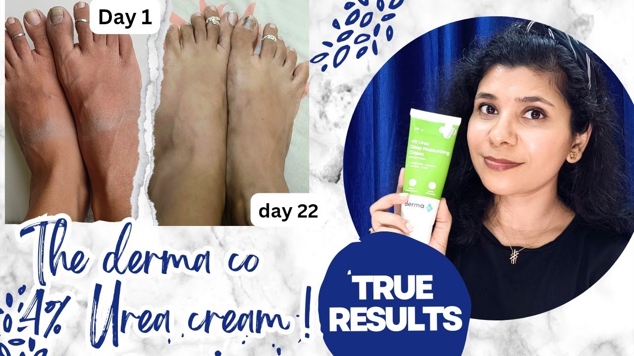 The derma co 4% Urea deep moisturizing cream | Detailed review with ...