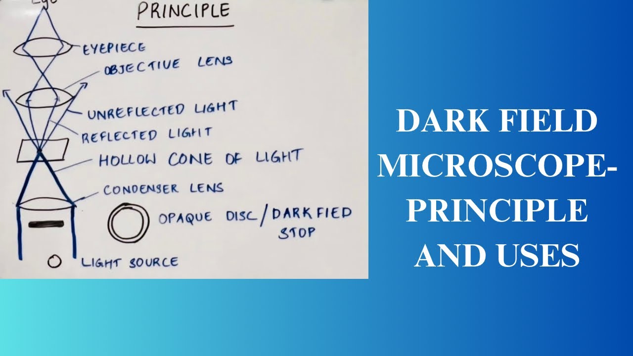 Dark field Microscope- Principle| Uses - YouTube