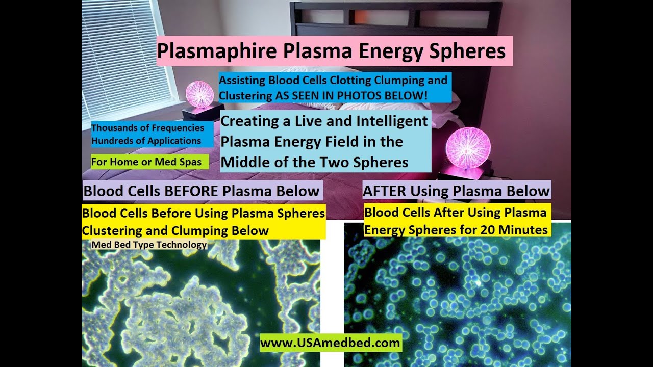 Plasma Energy Spheres Assisting with Blood Clots and More - YouTube