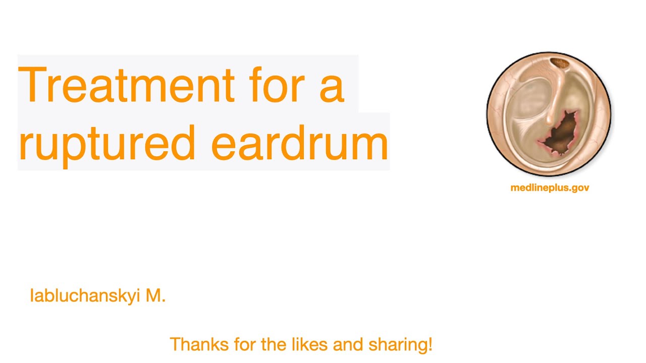 Treatment For A Ruptured Eardrum YouTube