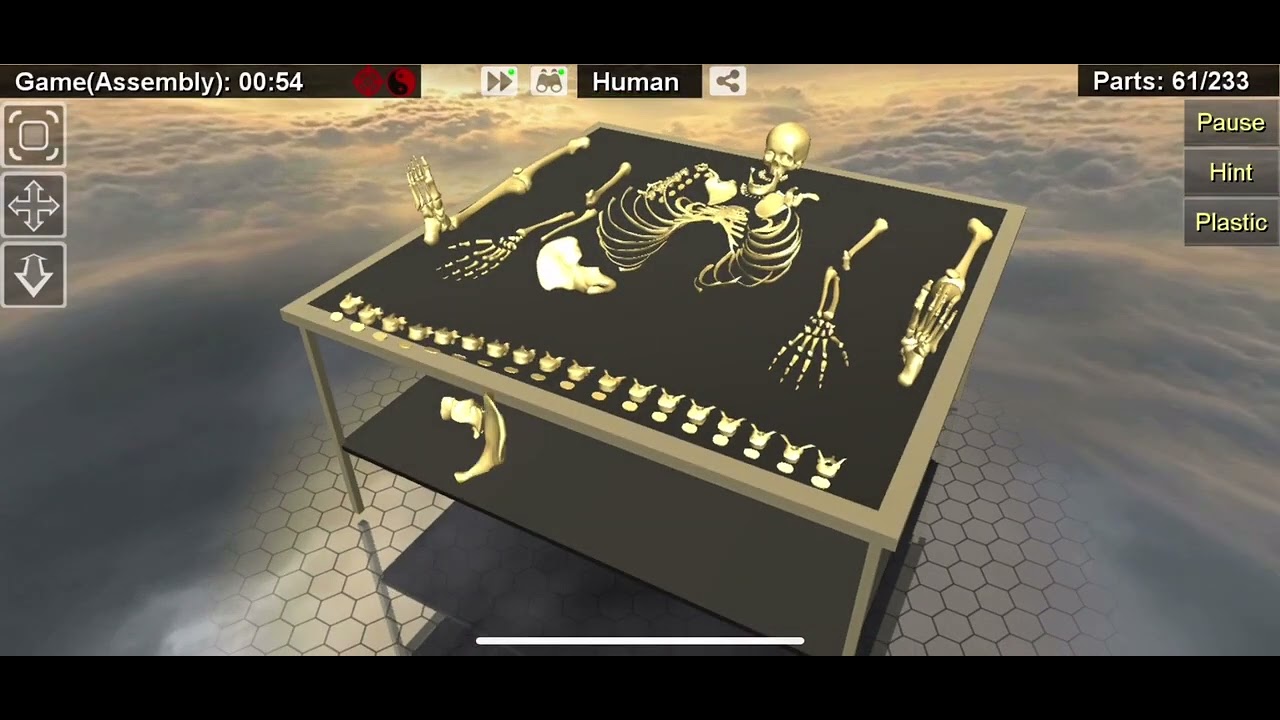 And when the Patient woke up: his skeleton was missing,and the doctor ...