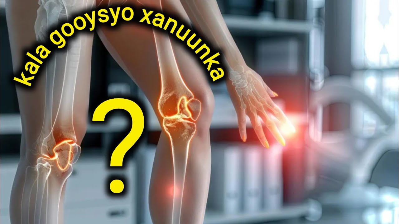 Xanuunka lafaha , kala goosyada sida jilbaha wax kaste oo sababo ...