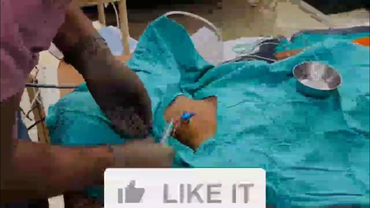 Central or Femoral Line Procedure Step By Step|CVP LINE/CENTRALLINE/CENTRAL VENOUSCATHETER ...