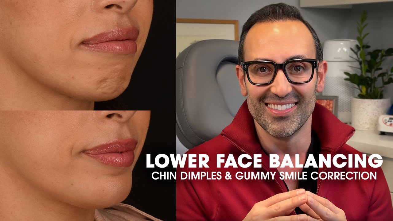 Non-Surgical Lower Face Balancing | Dr. Kian - YouTube