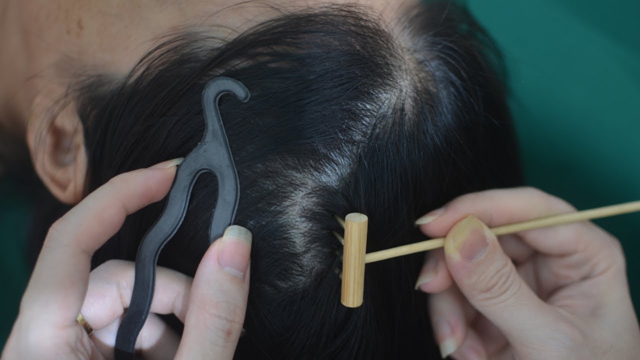 ASMR Hair Combing & Parting, Real Person Scalp Scratch For Relieve ...
