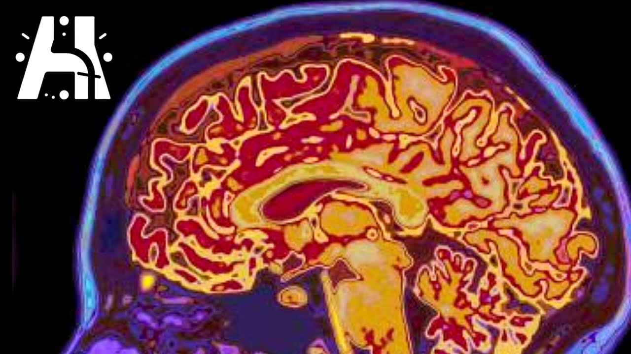 Be Aware - Brain Does Overheat - YouTube