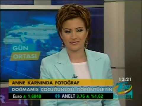 Anne Karnında Fotoğraf | Doğmamış Çocuğunuzu Görüntüleyin | TGRT