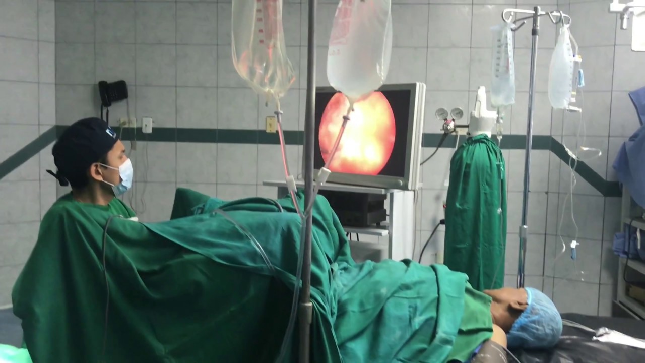 RESECCION TRANSURETRAL DE PROSTATA (RTU P) - YouTube