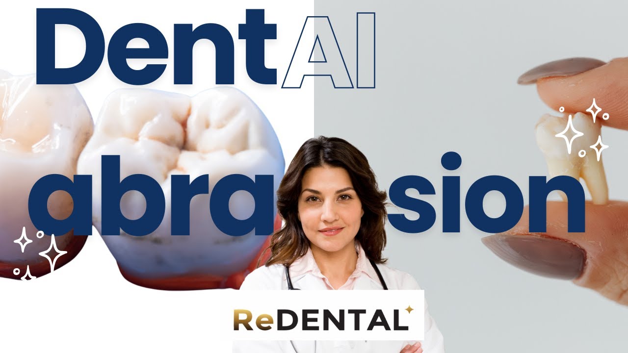 What is Dental Abrasion? Causes, Prevention & Treatment | Redental ...