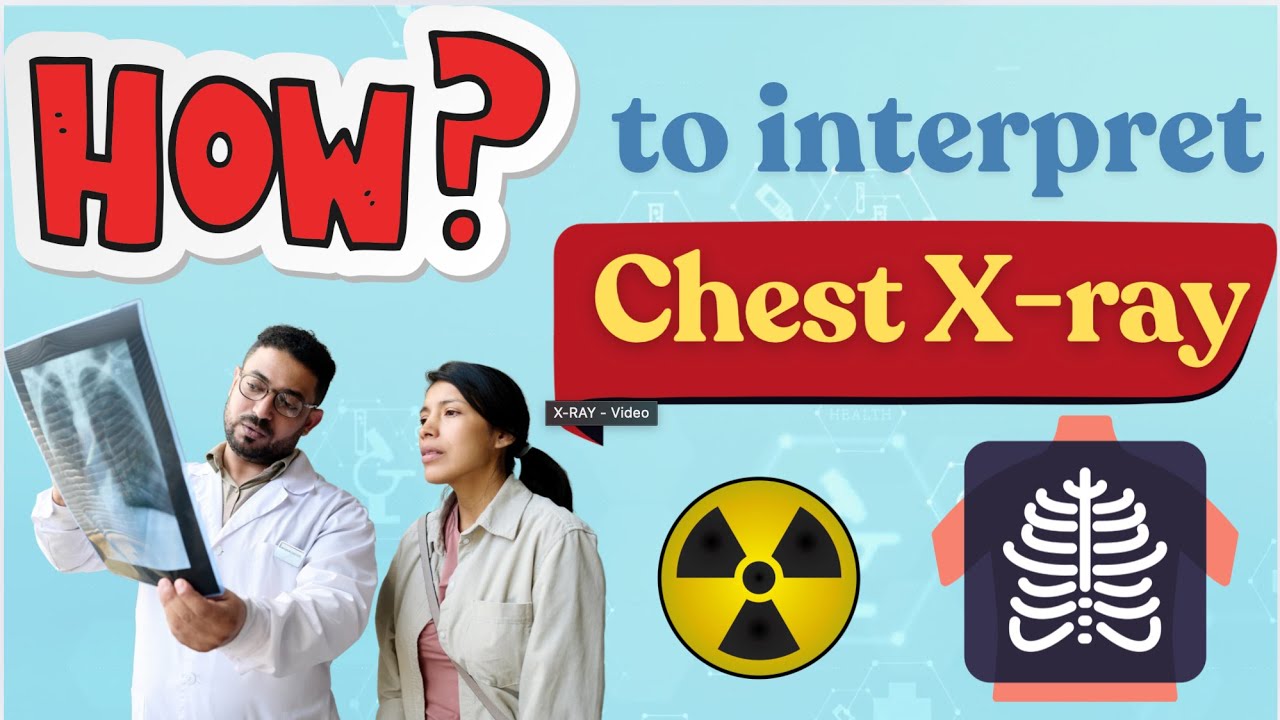 How to interpret Chest x-ray : simple ways to interpret # #nursing # ...
