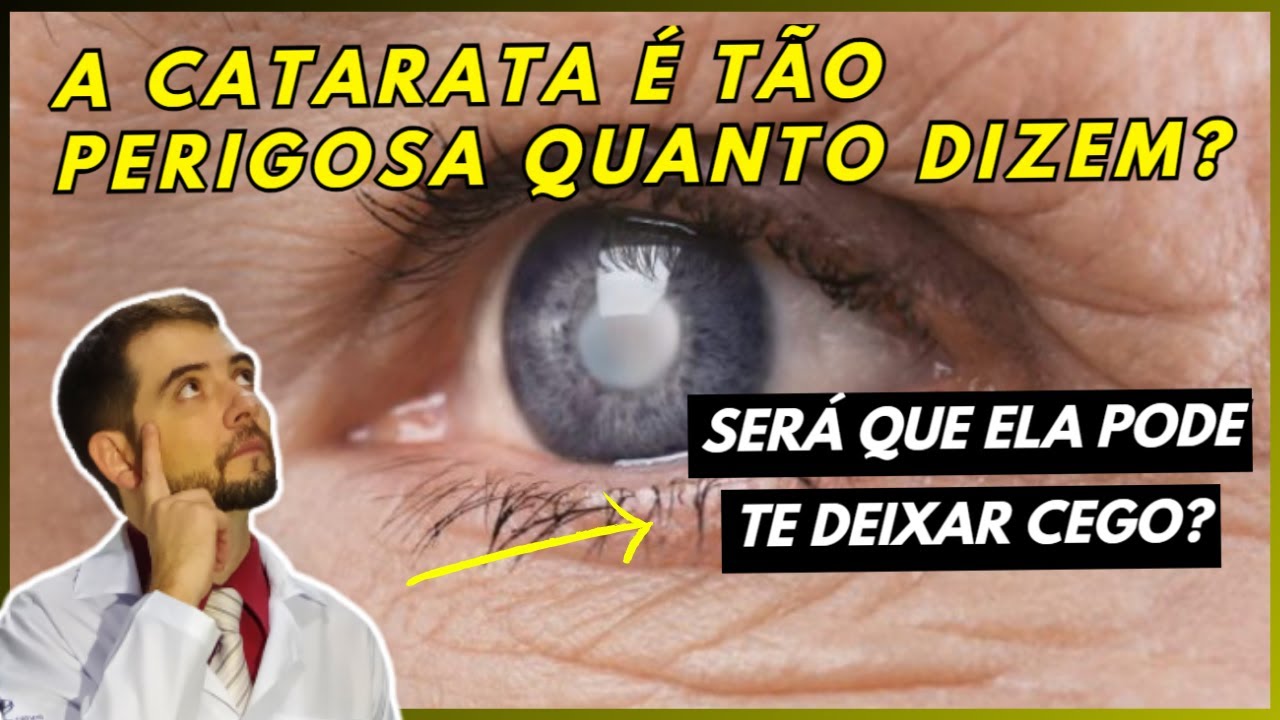 O QUE É CATARATA NOS OLHOS? - O QUE CAUSA? - OFTALMOLOGIA - YouTube