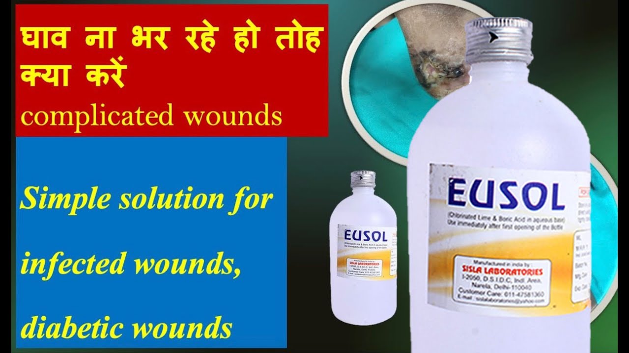 EUSOL घाव ना भर रहे हो तोह क्या करें (non. graphic) - YouTube