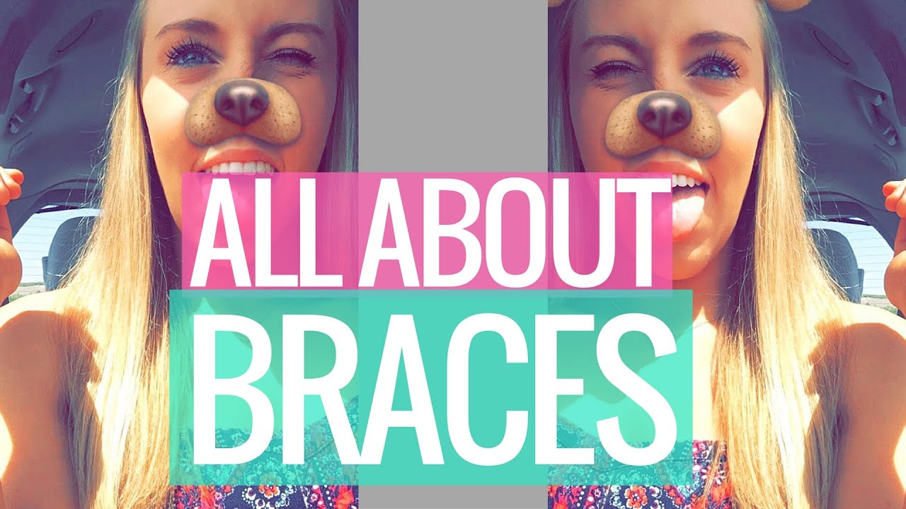 All About Braces and Retainers (Before, During, & After) - YouTube