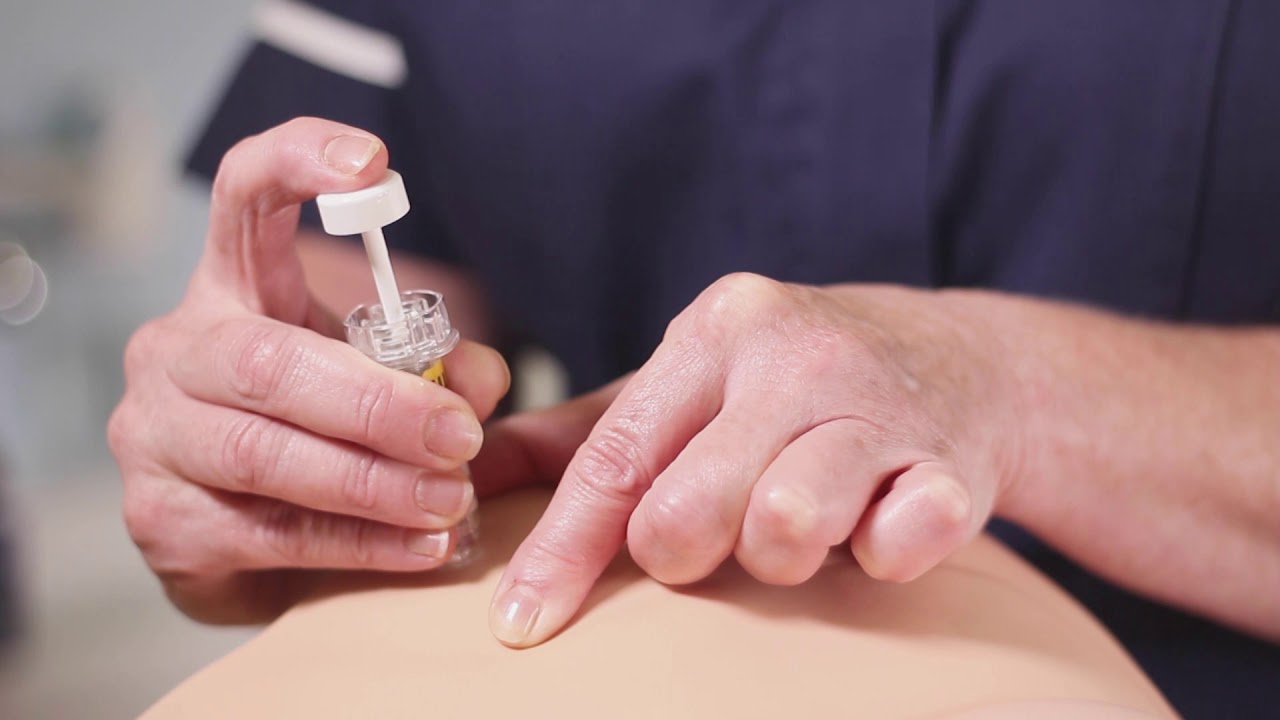 East Kent Urology Patient Information Series: Robotic Prostatectomy 17 ...