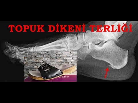 Topuk Dikeni Ağrısından Kurtulmak İsteyenlere Özel Terlik (Detaylı İnceleme)