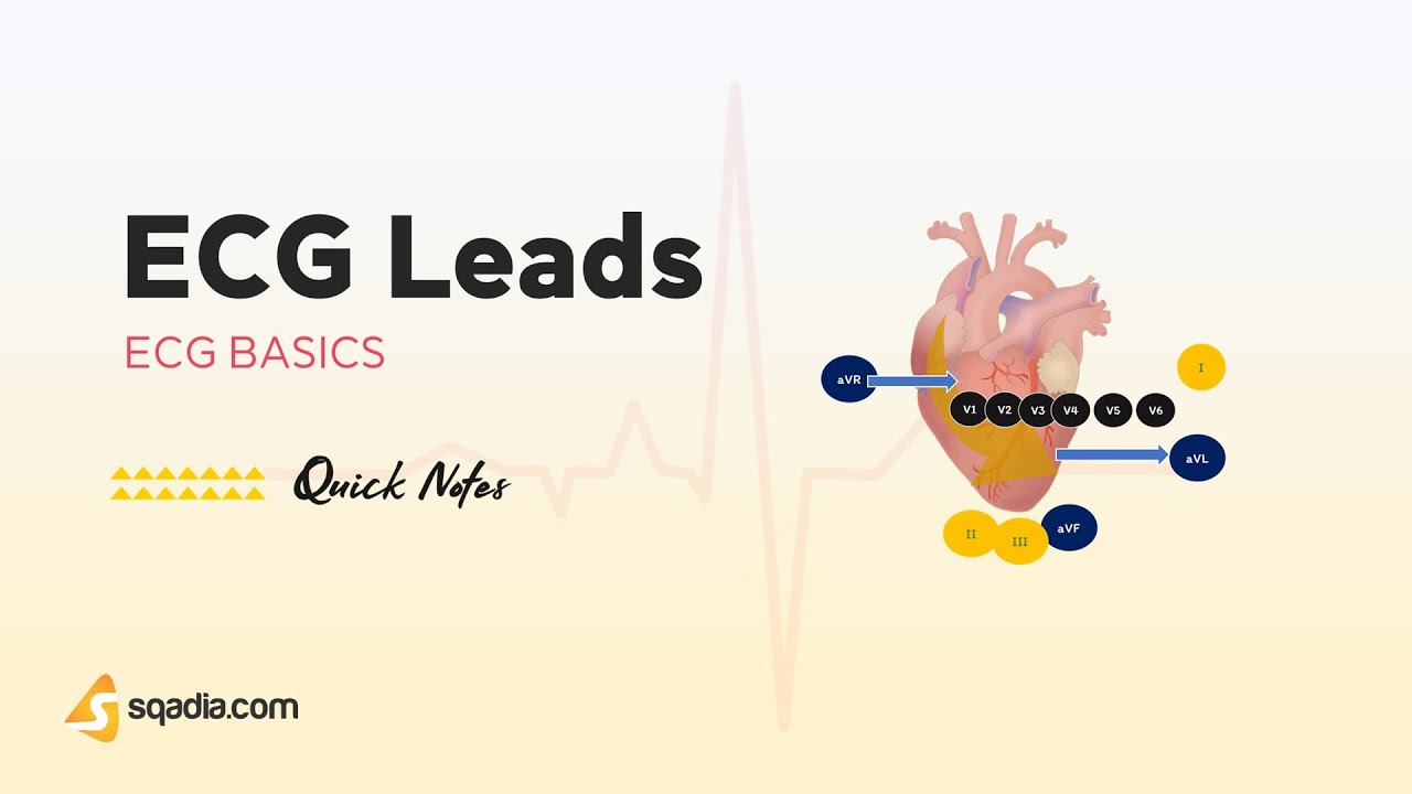 ECG Basics | ECG Leads | Basic Electrocardiogram (ECG) Made Easy ...