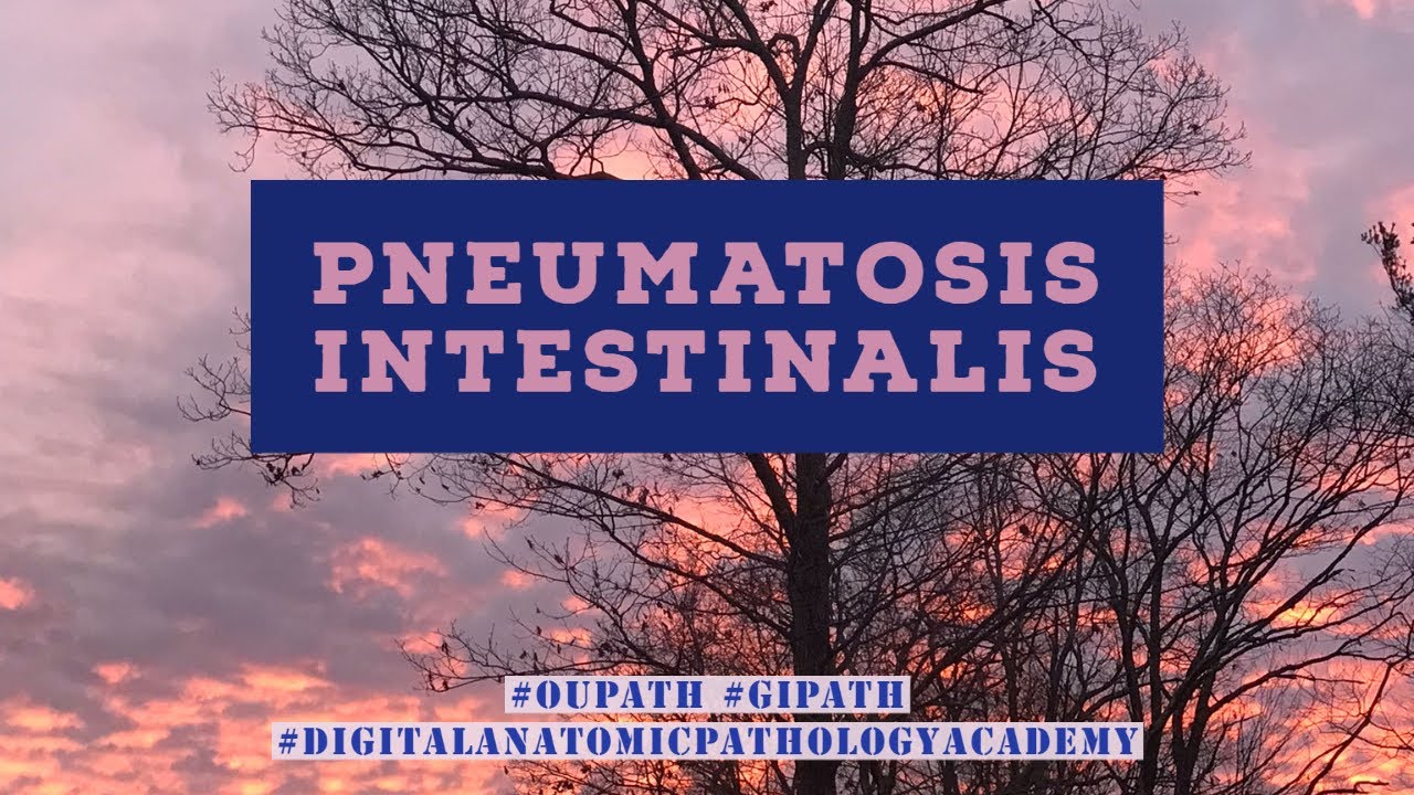Pneumatosis Intestinalis - YouTube