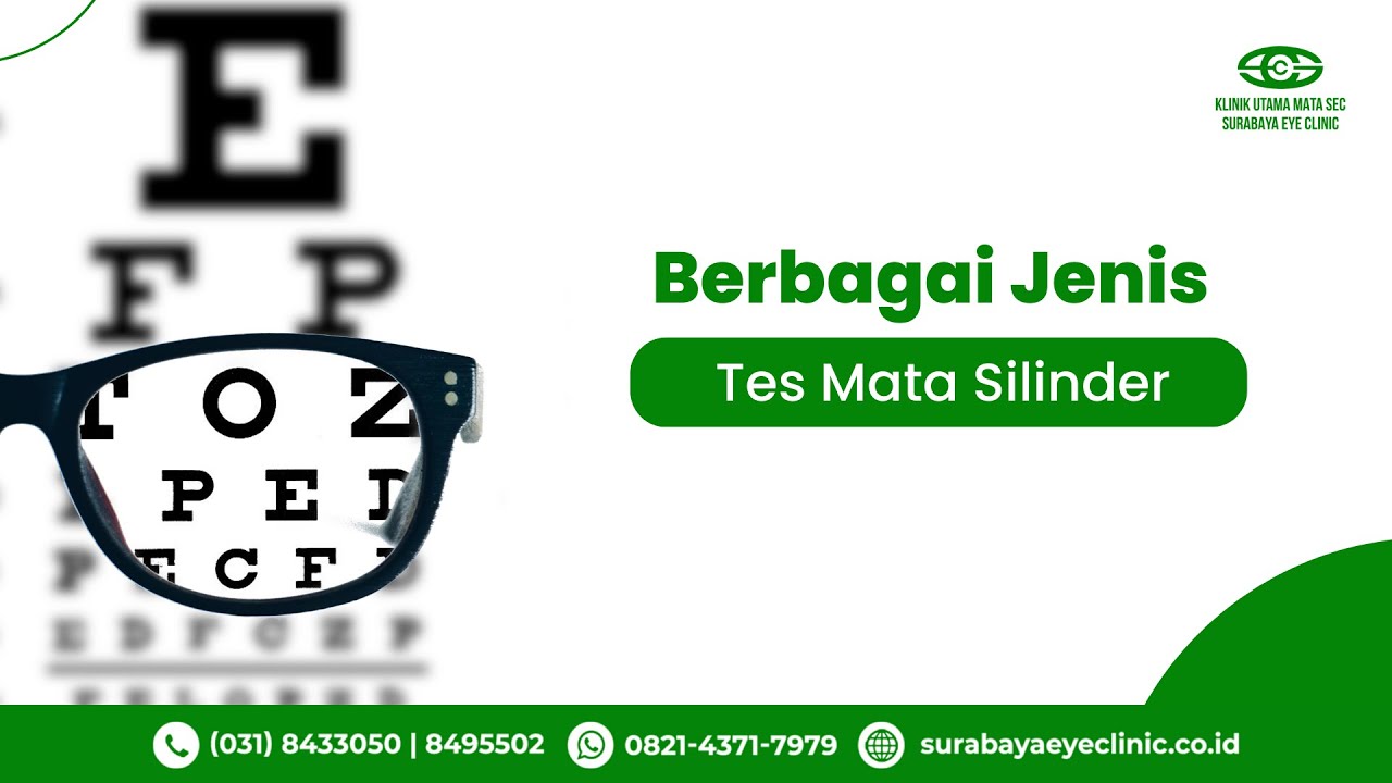 Berbagai Jenis Tes Mata Silinder - YouTube