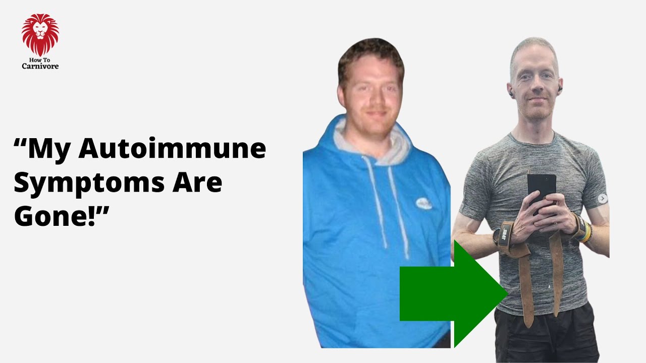 How Ali Put His Autoimmune Into Remission - YouTube