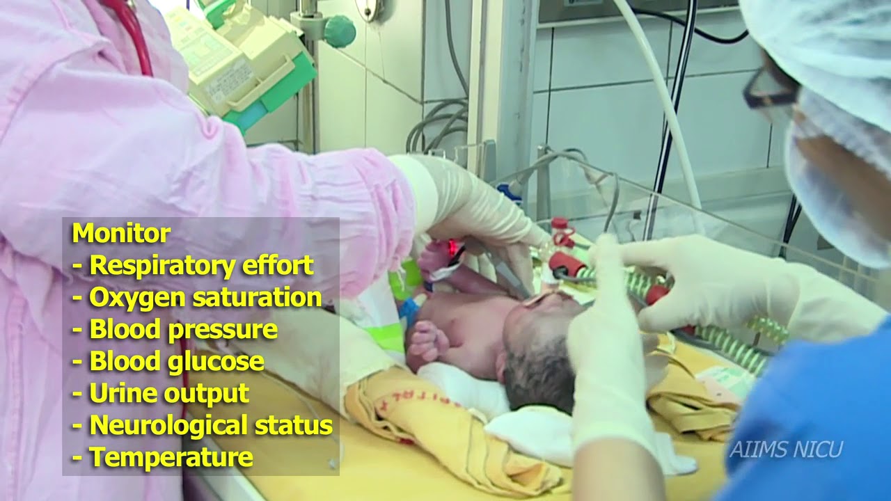 Post resuscitation care - YouTube