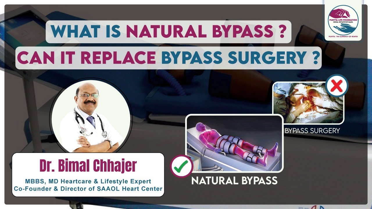 What is Natural Bypass? Can it replace Bypass Surgery? | Dr Bimal ...