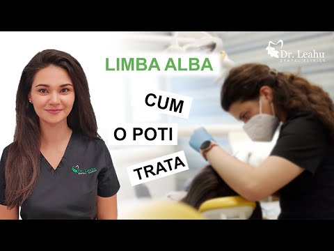 Ce inseamna cand ai limba alba.Afla ce spune limba despre sanatatea ta ...