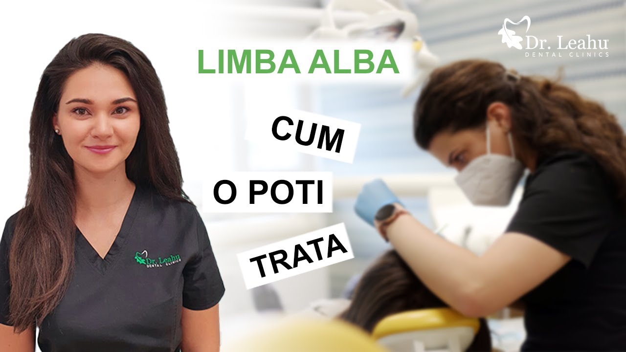 Ce inseamna cand ai limba alba.Afla ce spune limba despre sanatatea ta ...