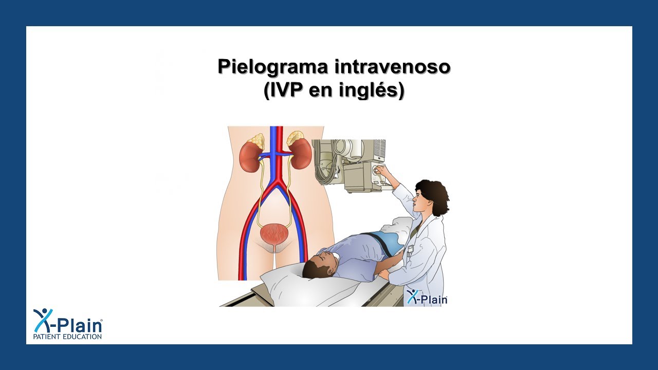 Pielograma intravenoso (IVP en inglés) - YouTube
