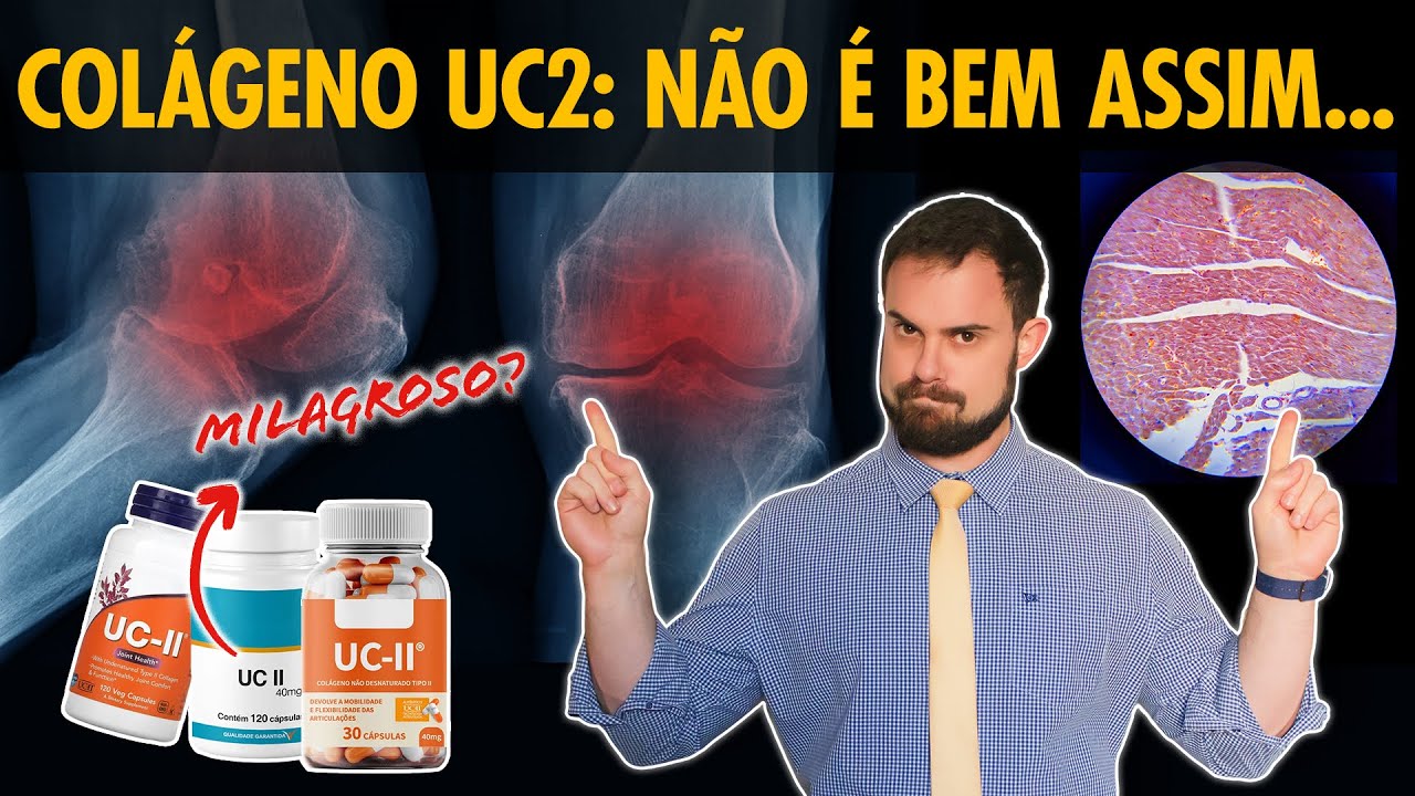 UC2 (COLÁGENO TIPO 2): ENTENDA DE UMA VEZ - YouTube