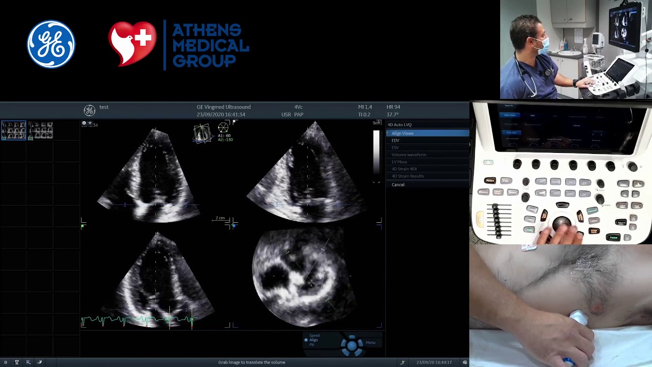 4D tutorials: 2. How to measure 4D EF and volumes with AutoLVQ - YouTube