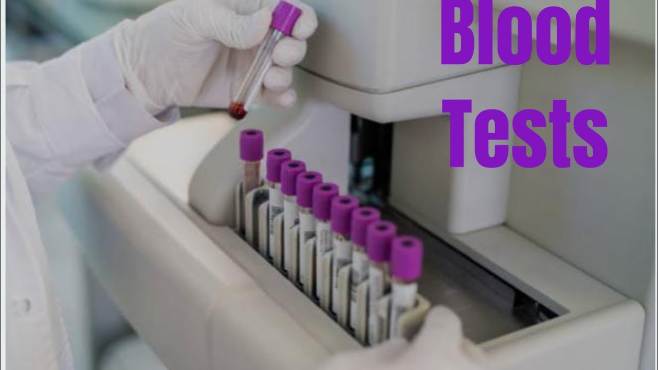 Blood- Presumptive and Confirmatory tests - YouTube