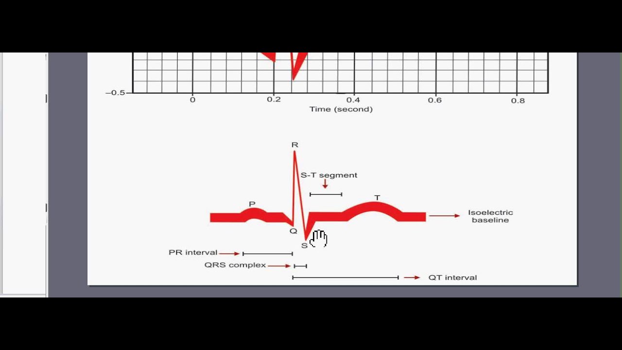 Basic concepts of ECG and the analysis of the graph part 2 - YouTube