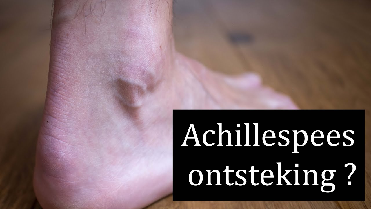Wat kun je doen aan een pijnlijke achillespees? - YouTube