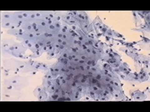 Pap Smear Motion Parallax edge 3D microscope - YouTube