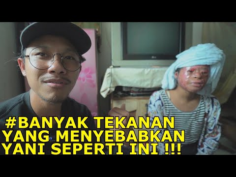 OPERASI MUKA YANI YG KEB4KAR KARNA LEM