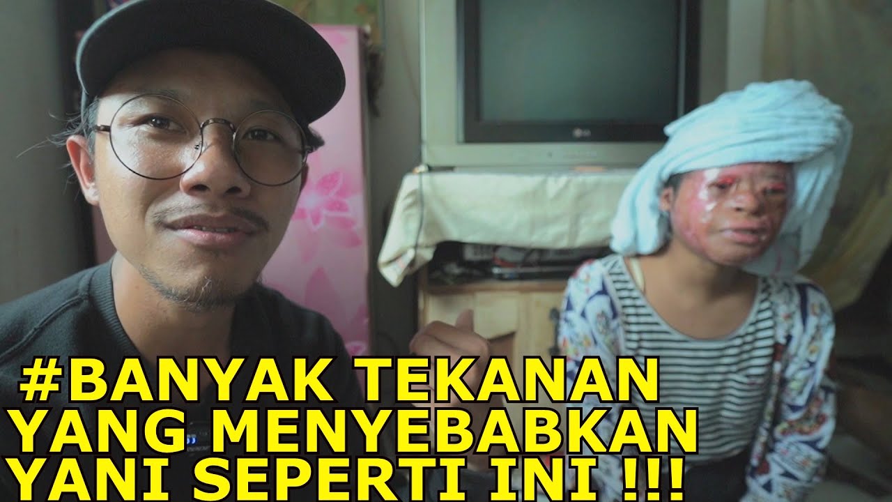 OPERASI MUKA YANI YG KEB4KAR KARNA LEM - YouTube