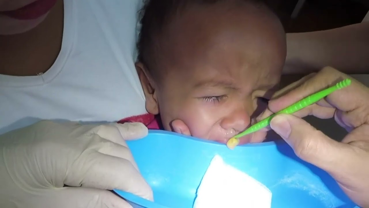 Removing A Foreign Body Stuck Inside Crying Girl's Nose | What is It ...