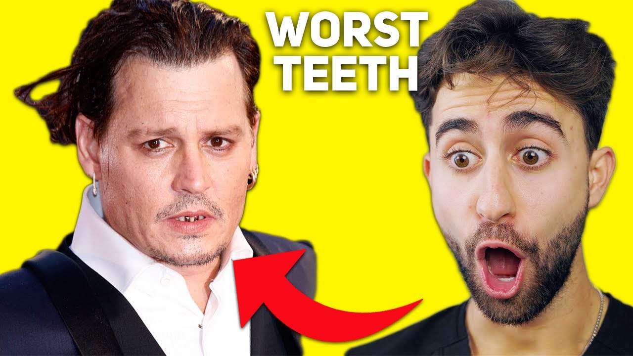 Johnny Depp Teeth johnny-depp-teeth