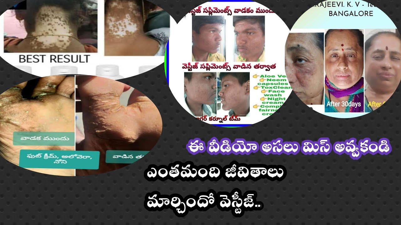 The power of vestige...Vestige Result photos... వెస్టీజ్ ద్వారానే ...