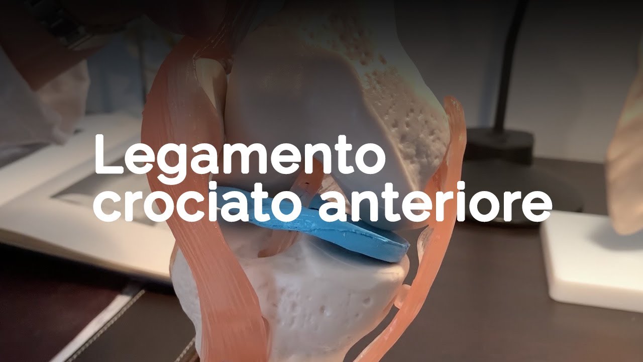Legamento Crociato Anteriore, operare o non operare? - YouTube