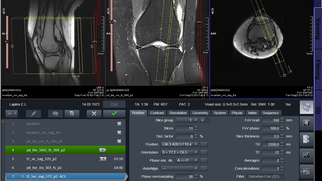 MRI planning Knee - YouTube