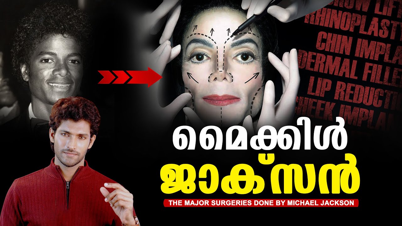 MICHAEL JACKSON | Face Transformation | Plastic Surgery Failure - YouTube