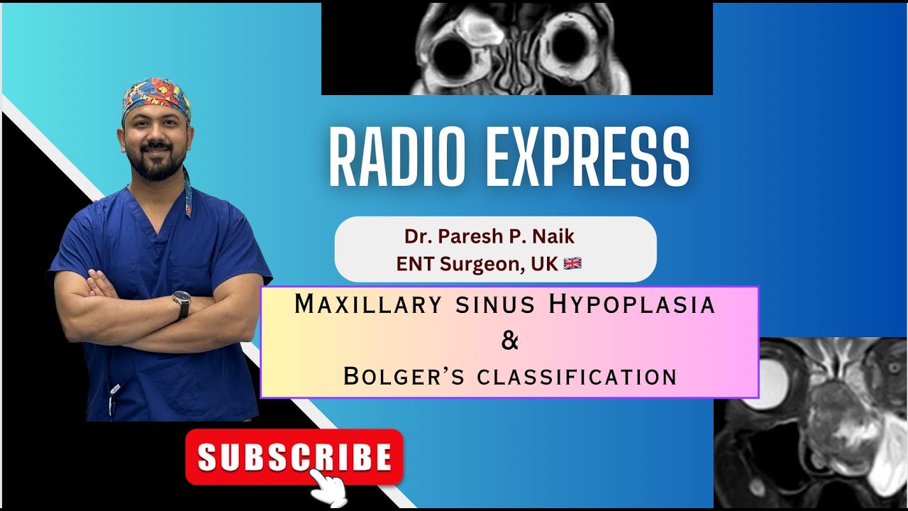 Maxillary sinus hypoplasia & Bolger Classification - YouTube