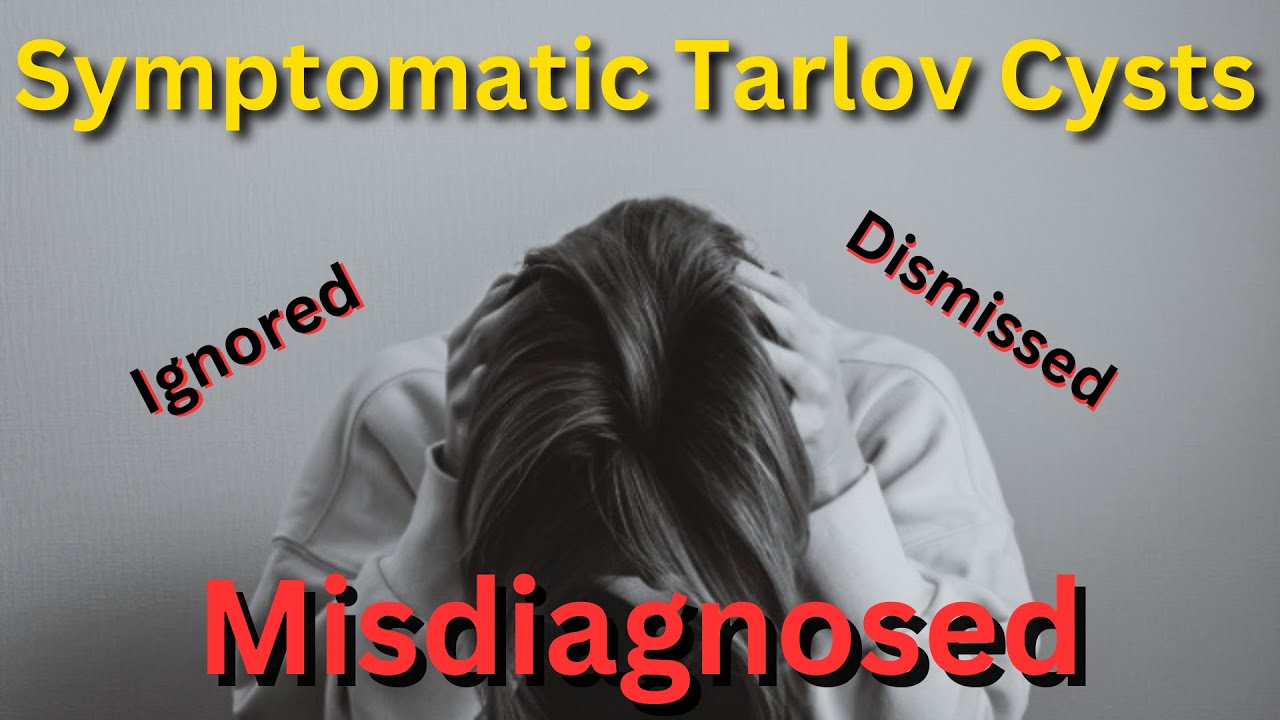 Symptomatic Perineural Cysts: Dismissed, Ignored, and Misdiagnosed - 85 ...