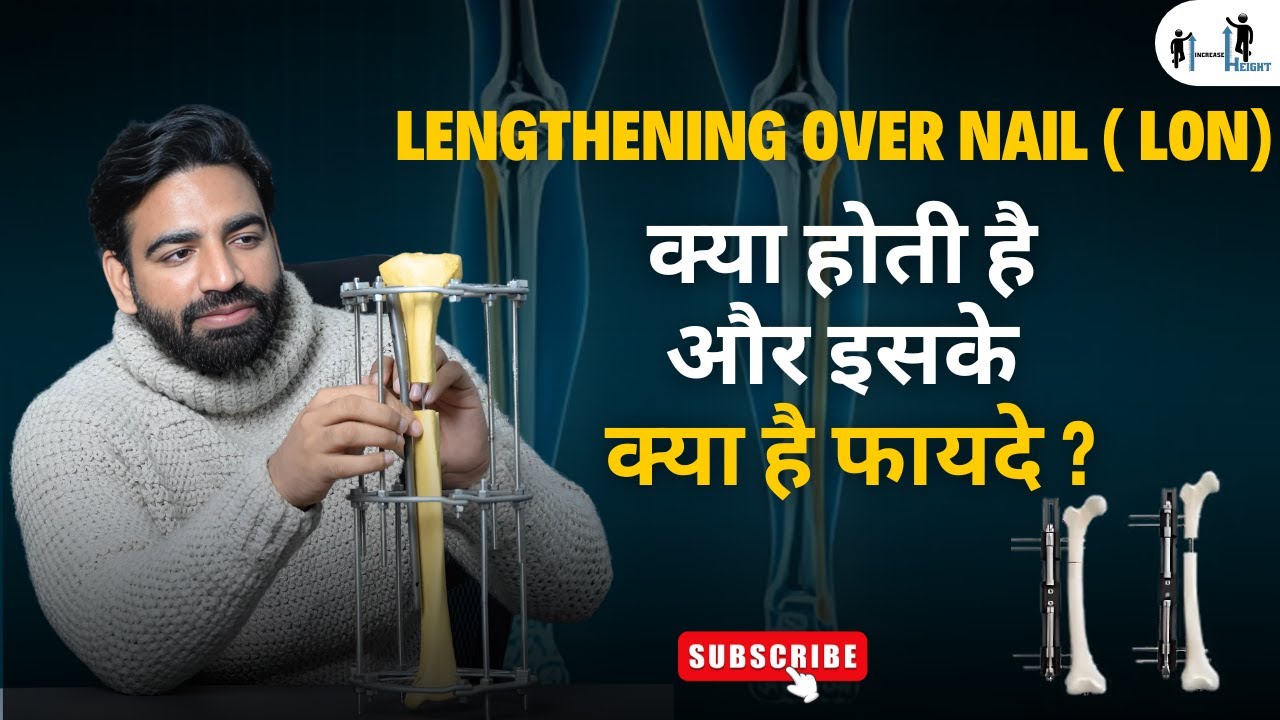 Lengthening Over Nail (LON) क्या होती है और इसके क्या है फायदे ? Limb ...