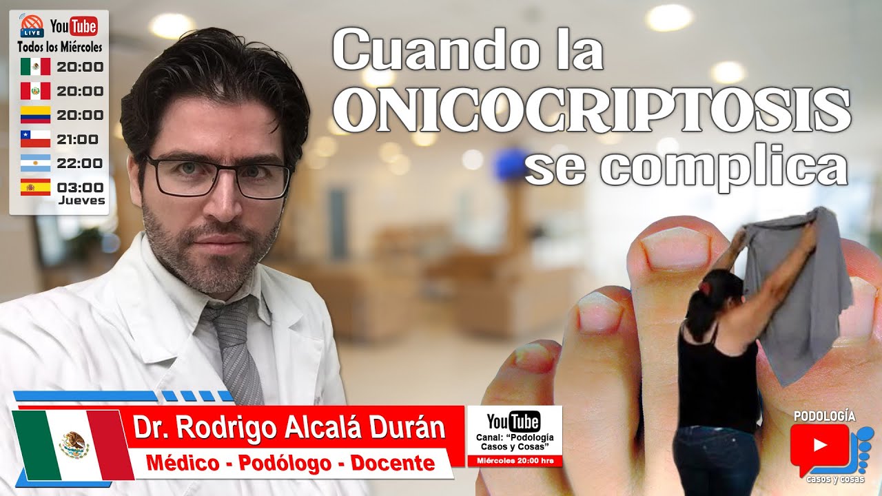 CUANDO LA ONICOCRIPTOSIS SE COMPLICA | Dr. Rodrigo Alcalá Durán ...