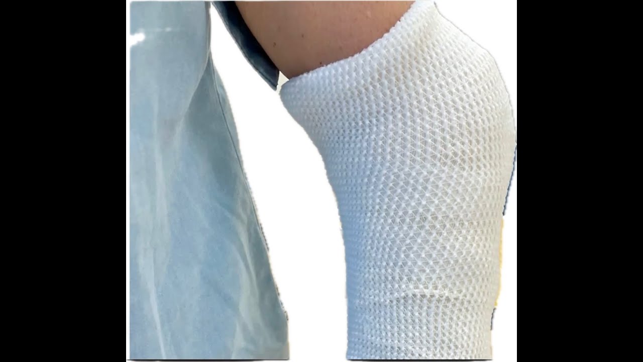 Sukker-tang skinne i X-lite gips. How to do! - YouTube