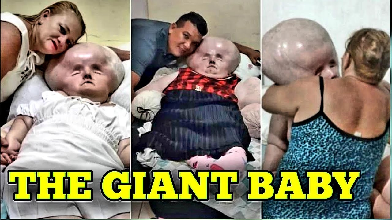 THE GIANT BABY | SHE IS 28 YEARS OLD | KNOWN AS THE GIANT BABY. - YouTube